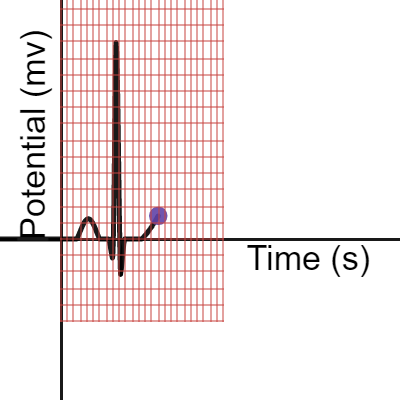 DH 81 - EKG | Desmos